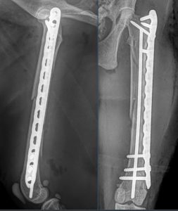 Basic Fracture Fixation - CPD Solutions’ Webinar Club